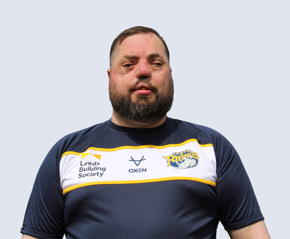Simon Brown - Leeds Rhinos Foundation